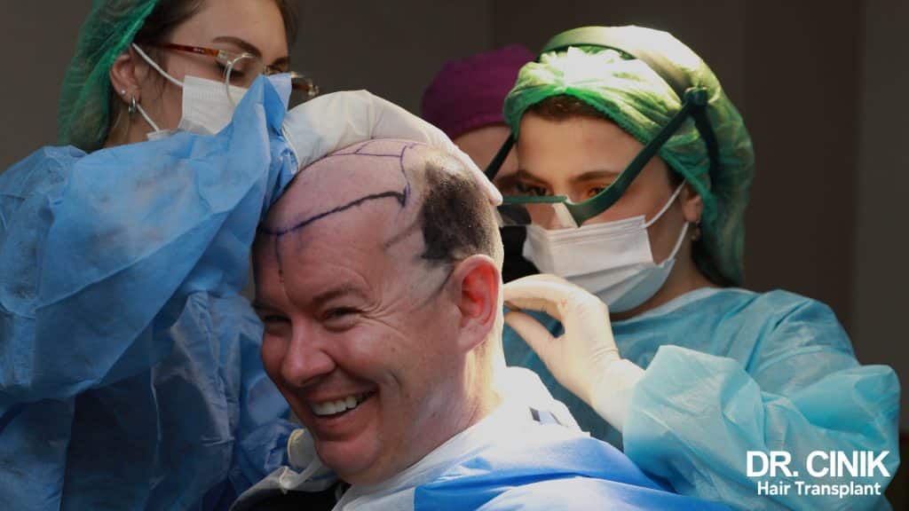 Calculate Your Hair Transplant Graft Count: A Comprehensive Guide