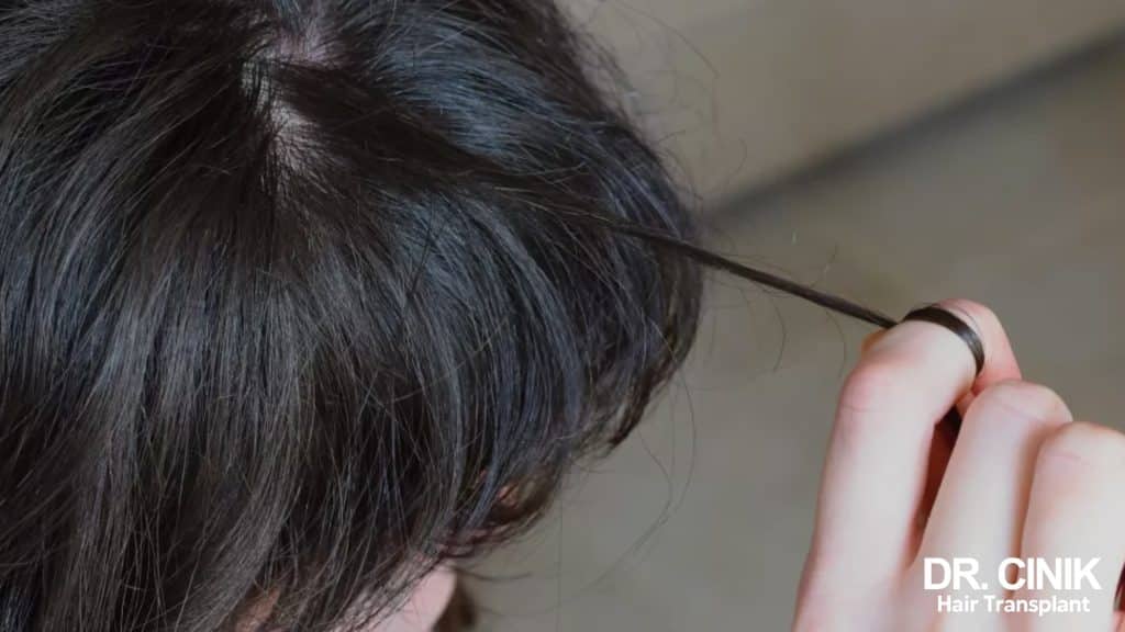 Trichotillomania: Understanding and Treating the Compulsive Hair ...