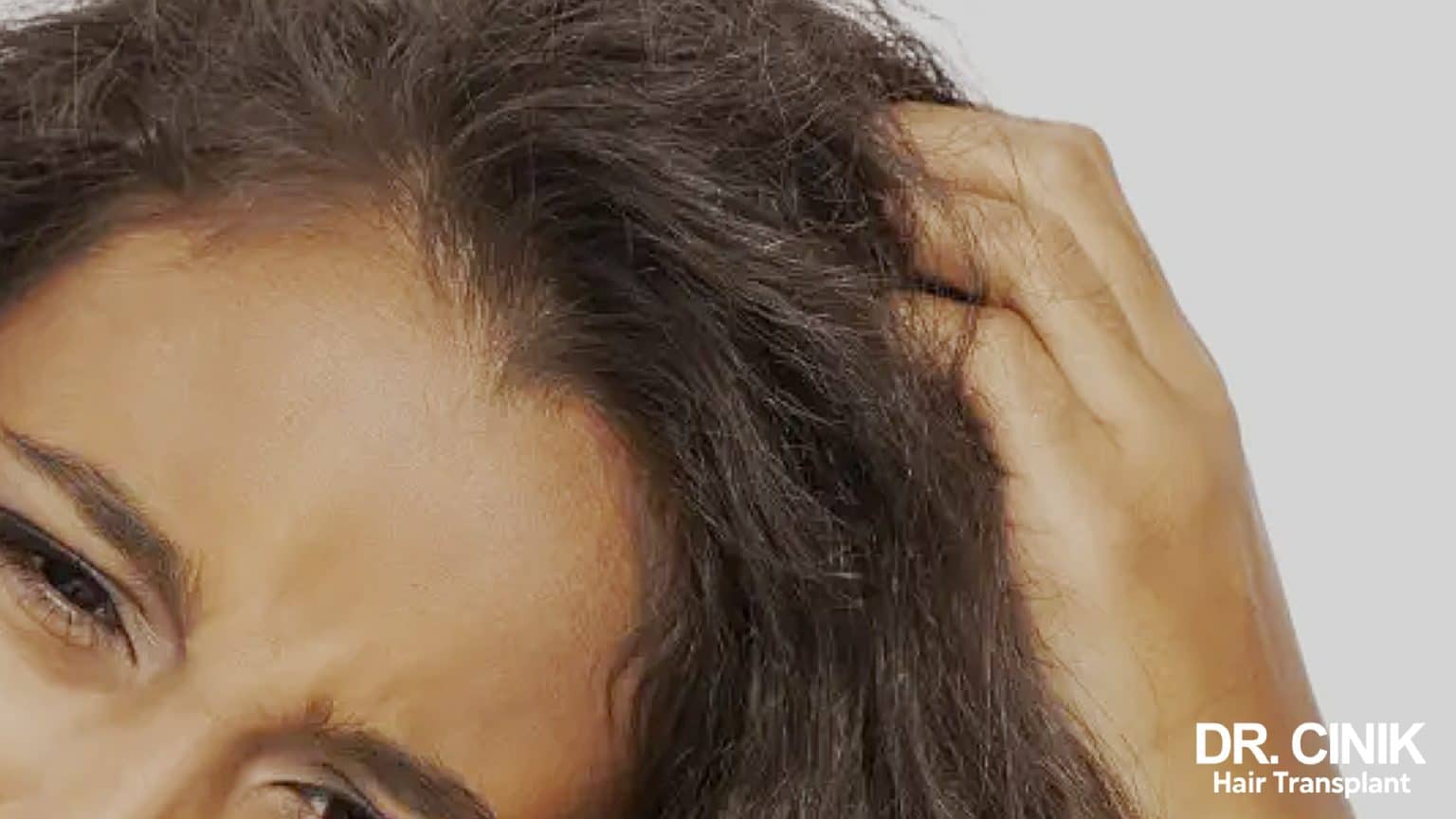 Traction Alopecia: The Consequence of Hair Mistreatment Leading to ...