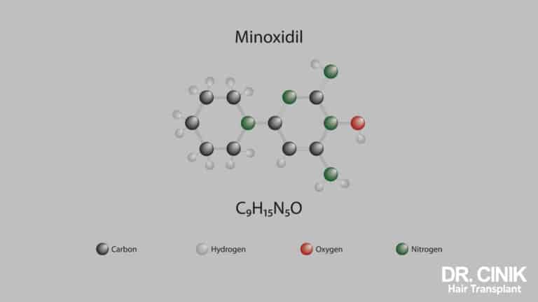 Minoxidil for Women: Solutions and Clinical Results | Dr Cinik