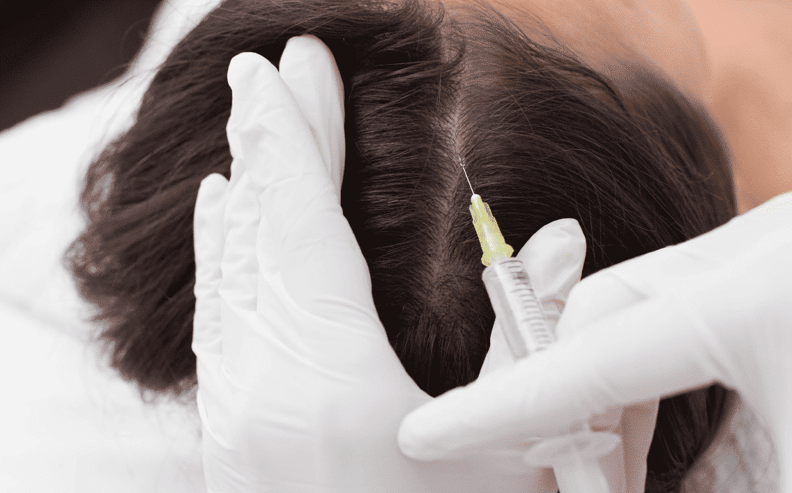 Exosomes Hair Treatment London | Dr Cinik Hair Loss Clinic
