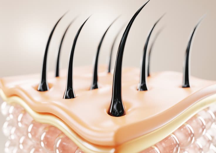 Laser Hair Growth Treatment London | Dr Cinik Hair Loss Clinic